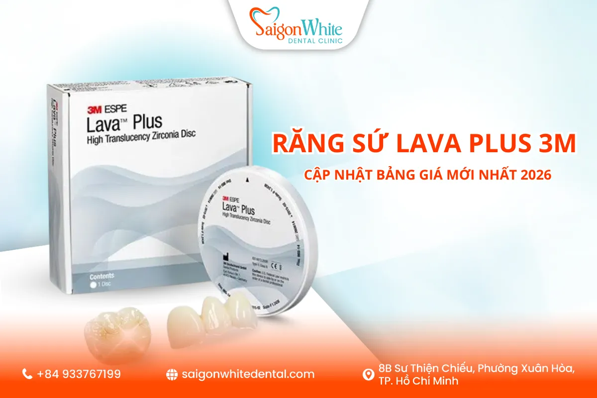 Răng sứ Lava Plus 3M là gì? Cập nhật bảng giá mới nhất 2026