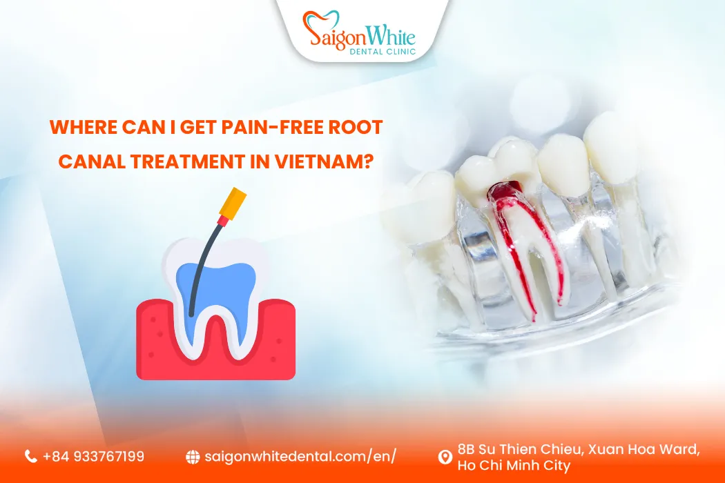 Where can I get pain-free root canal treatment in Vietnam? - Saigon ...