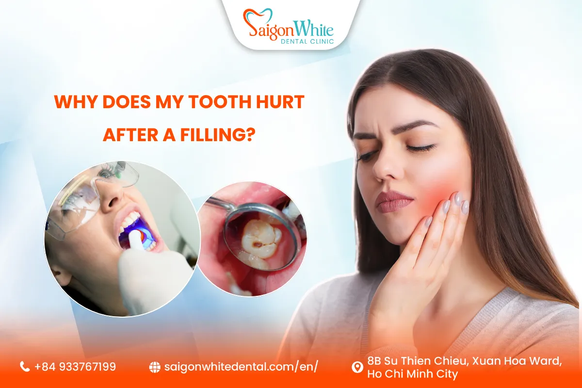 Why does my tooth hurt after a filling? - Saigon White Dental Clinic