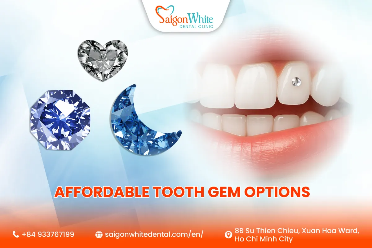 Affordable Tooth Gem Options for a Sparkling Smile - Saigon White ...