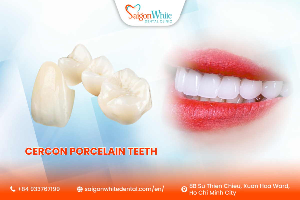 Cercon Porcelain Teeth Cost in Vietnam: Why Tourists Choose Dental ...