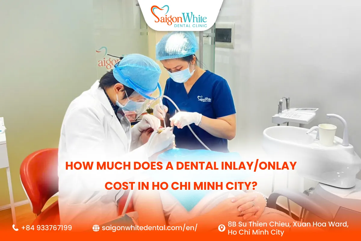How Much Does a Dental Inlay/Onlay Cost in Ho Chi Minh City? - Saigon ...