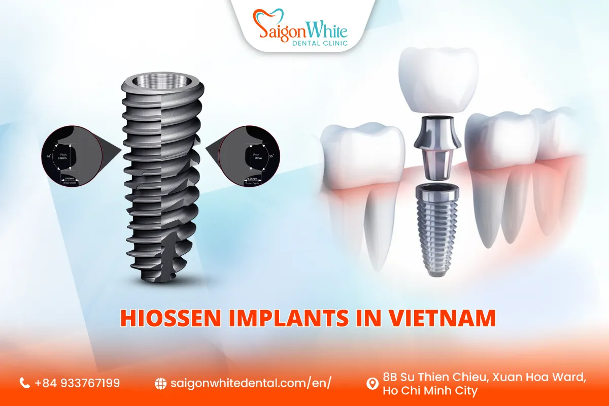 Hiossen Implants in Vietnam – Advanced Dental Implant Solutions from ...
